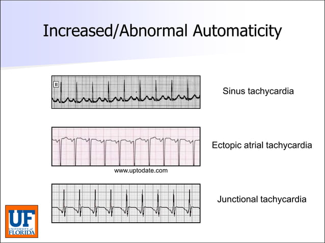 ECG [Compatibility Mode].pdf