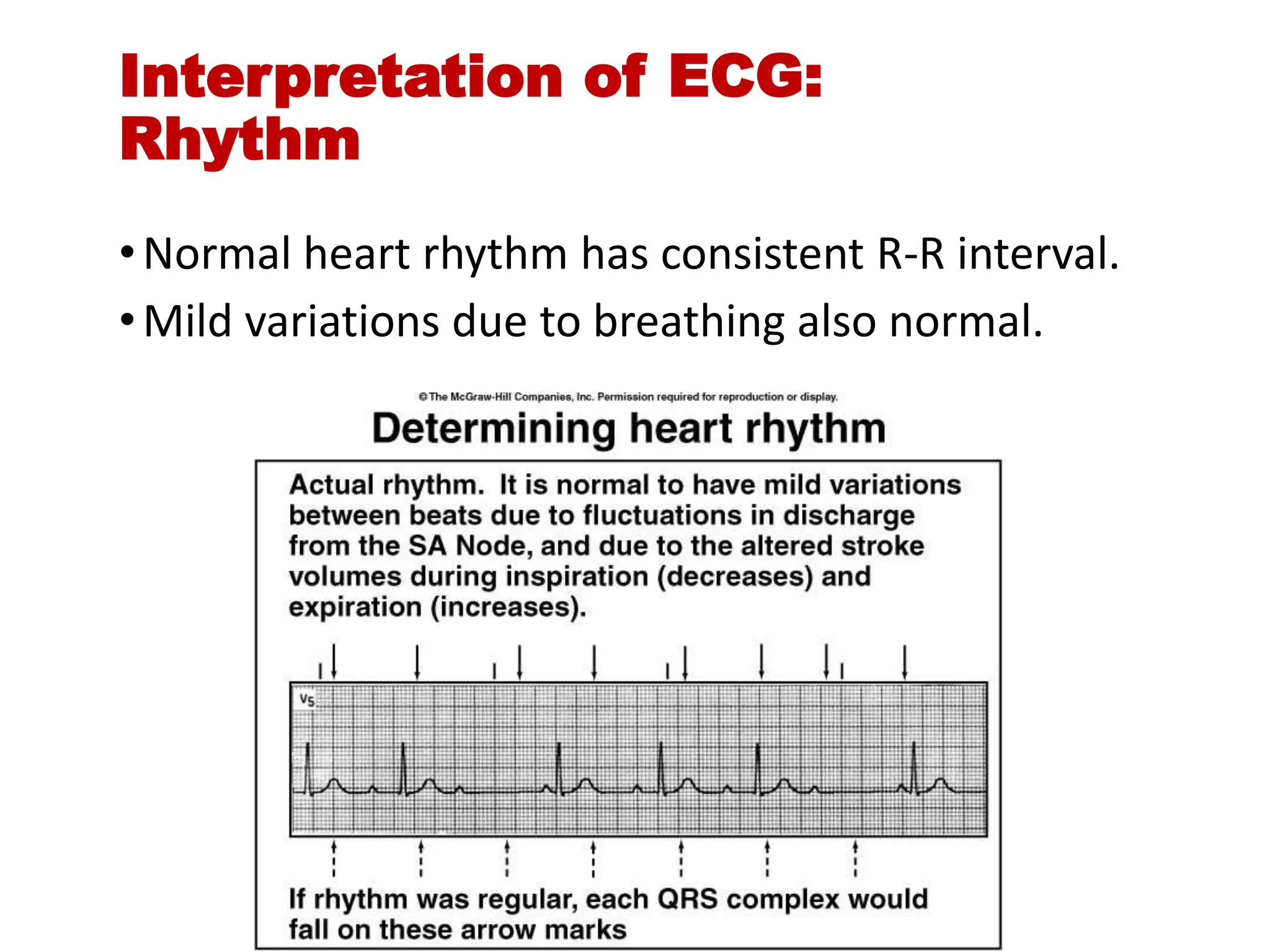 ECG complete lecture notes along with interpretation | PPTX