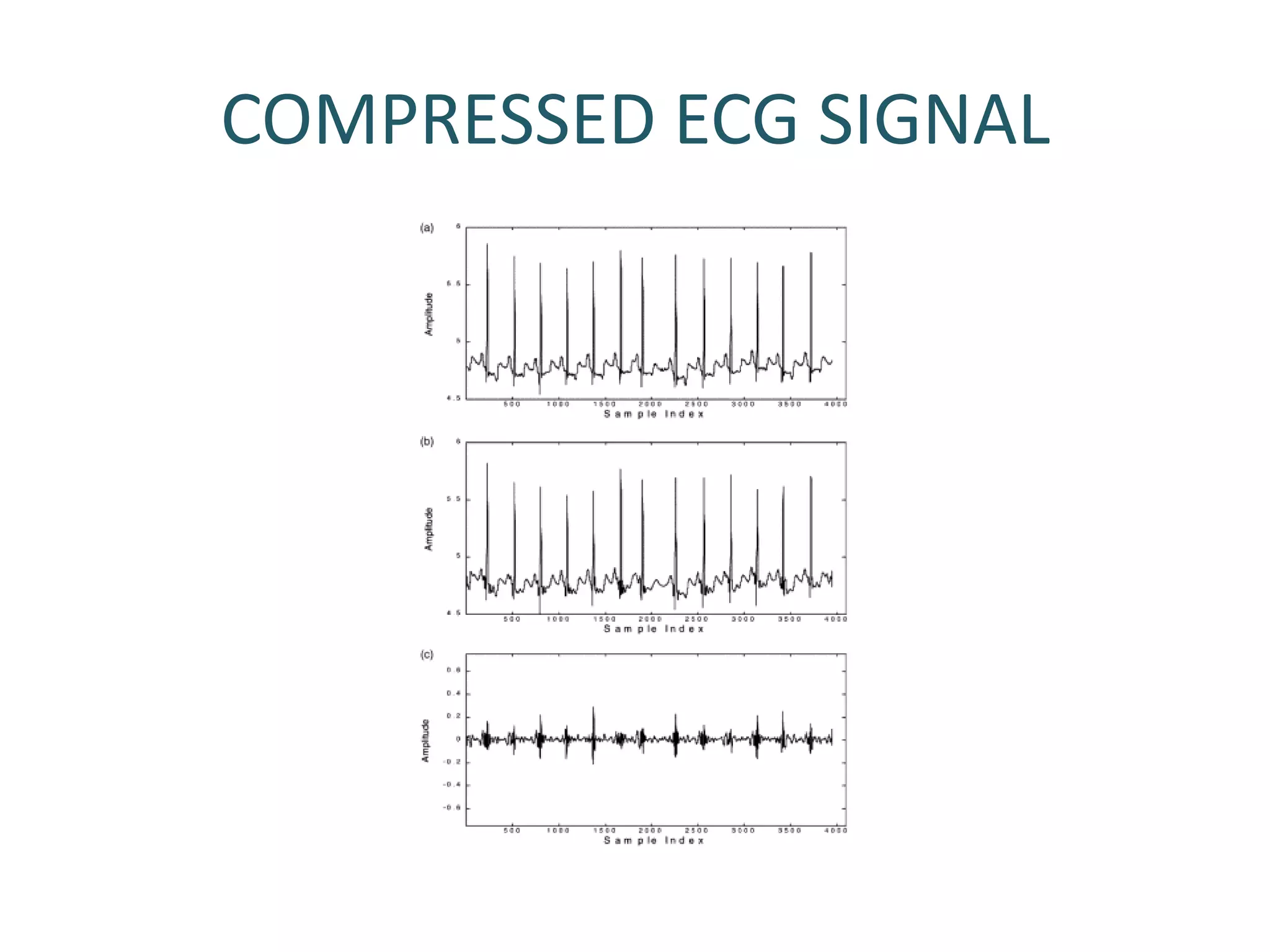 Ecg compression using fft | PPTX