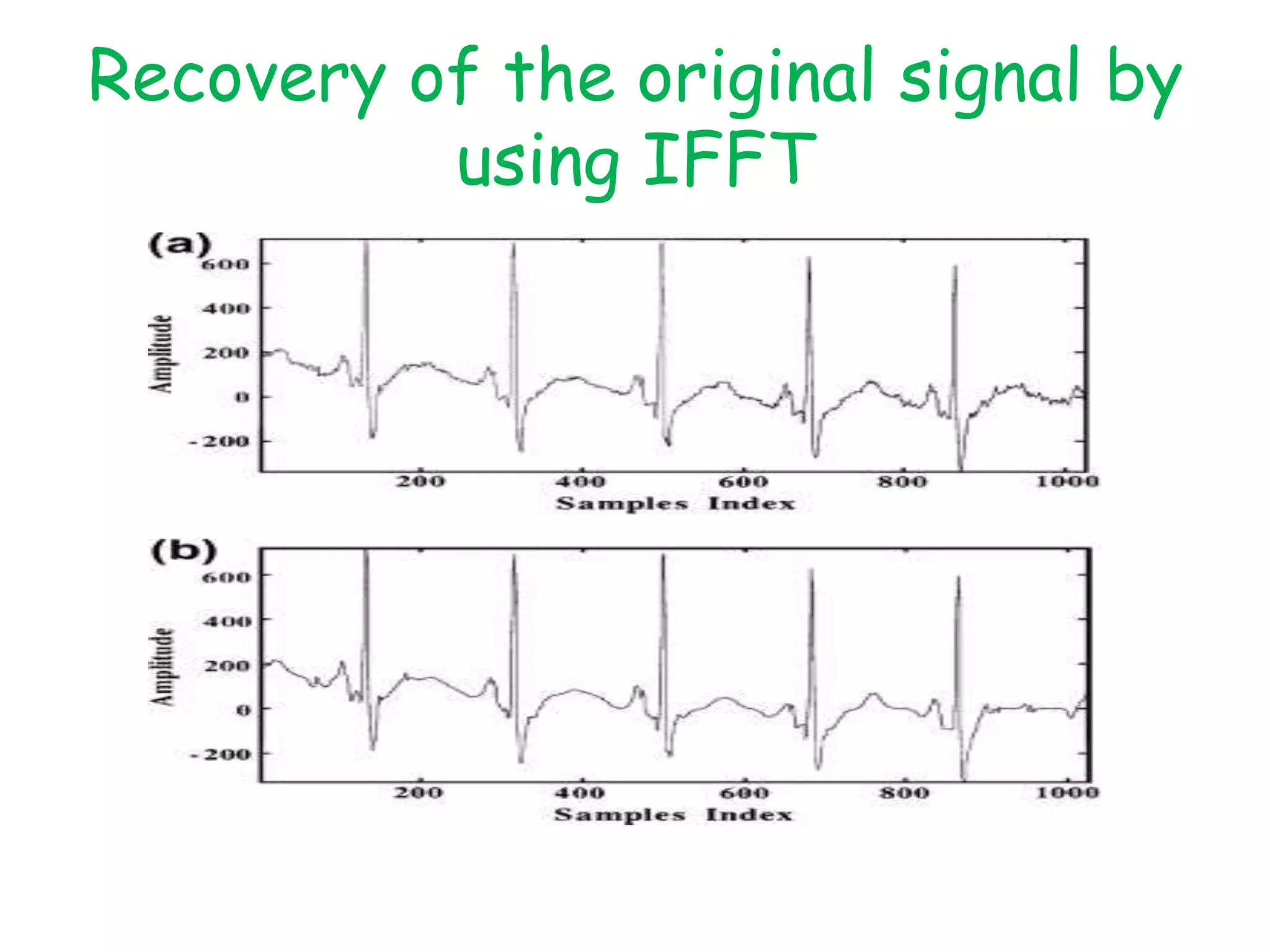 Ecg compression using fft | PPTX