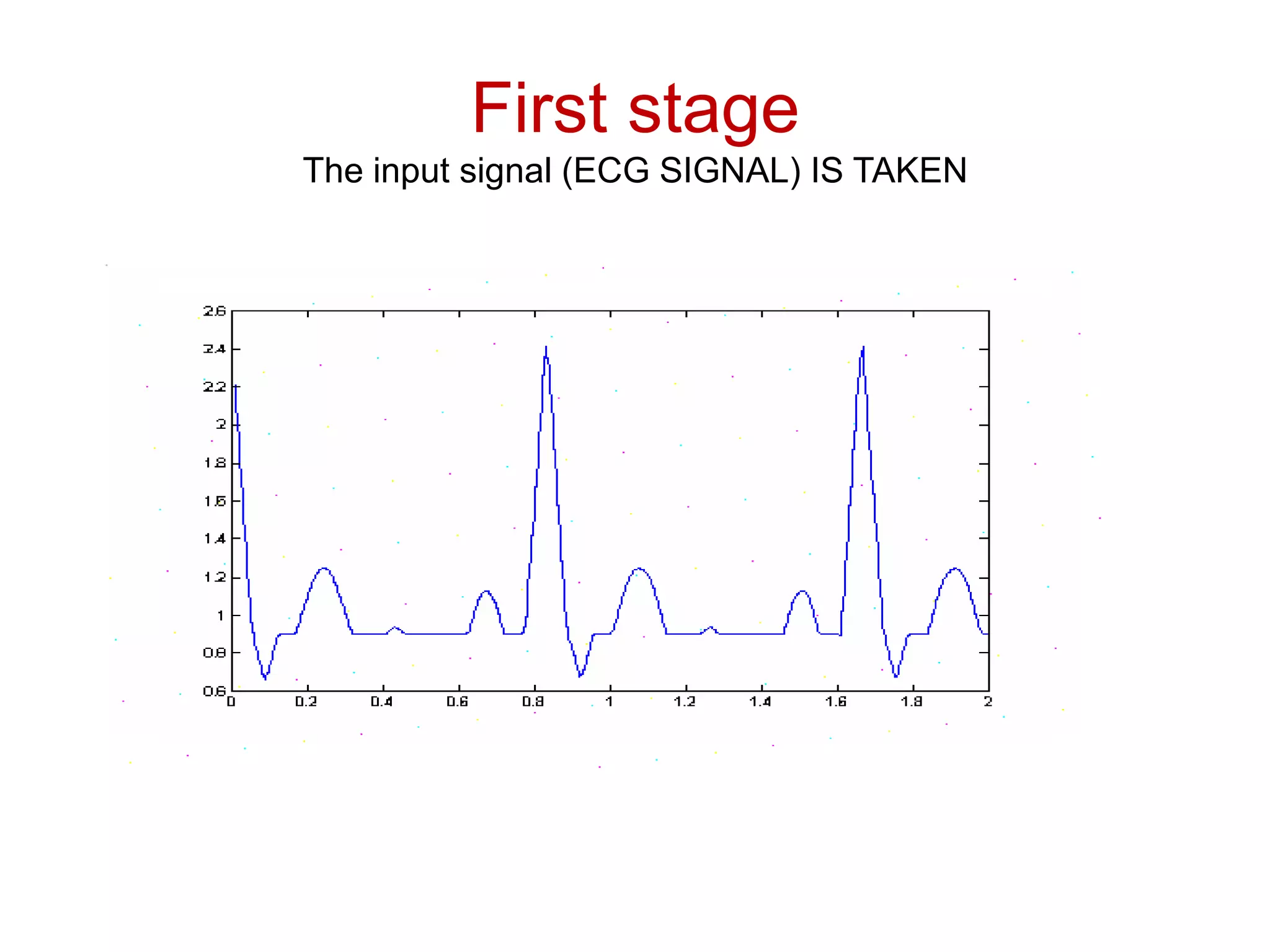 Ecg Compression Using Fft Pptx Digital Audio Computer Software