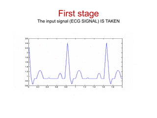 Ecg compression using fft | PPTX
