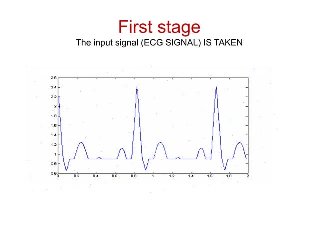 Ecg compression using fft | PPTX | Digital Audio | Computer Software and Applications
