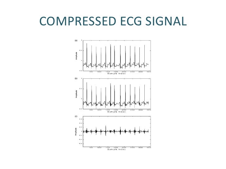 Ecg Compression Using Fft