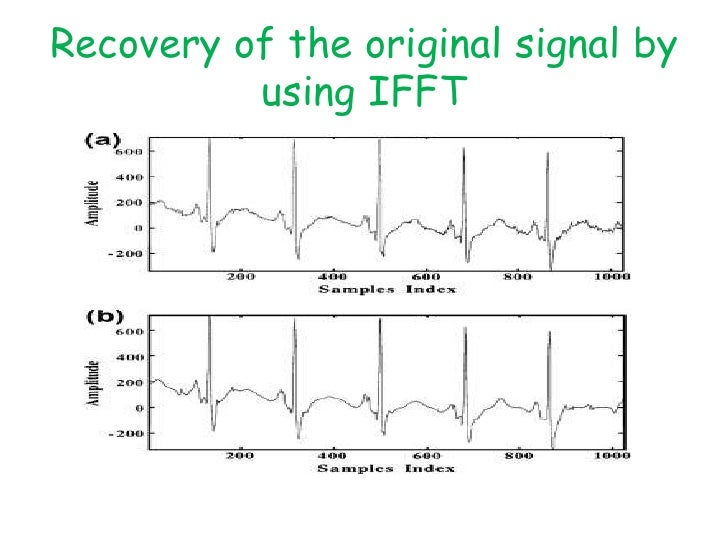 Ecg Compression Using Fft