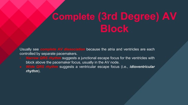 Ecg Conduction Abnormalities Pptx Heart And Cardiovascular Diseases Diseases And Conditions