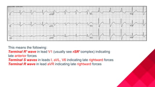 ECG Conduction Abnormalities | PPTX