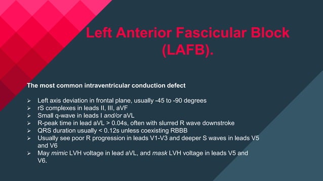 Ecg Conduction Abnormalities Ppt