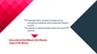 ECG Conduction Abnormalities | PPTX