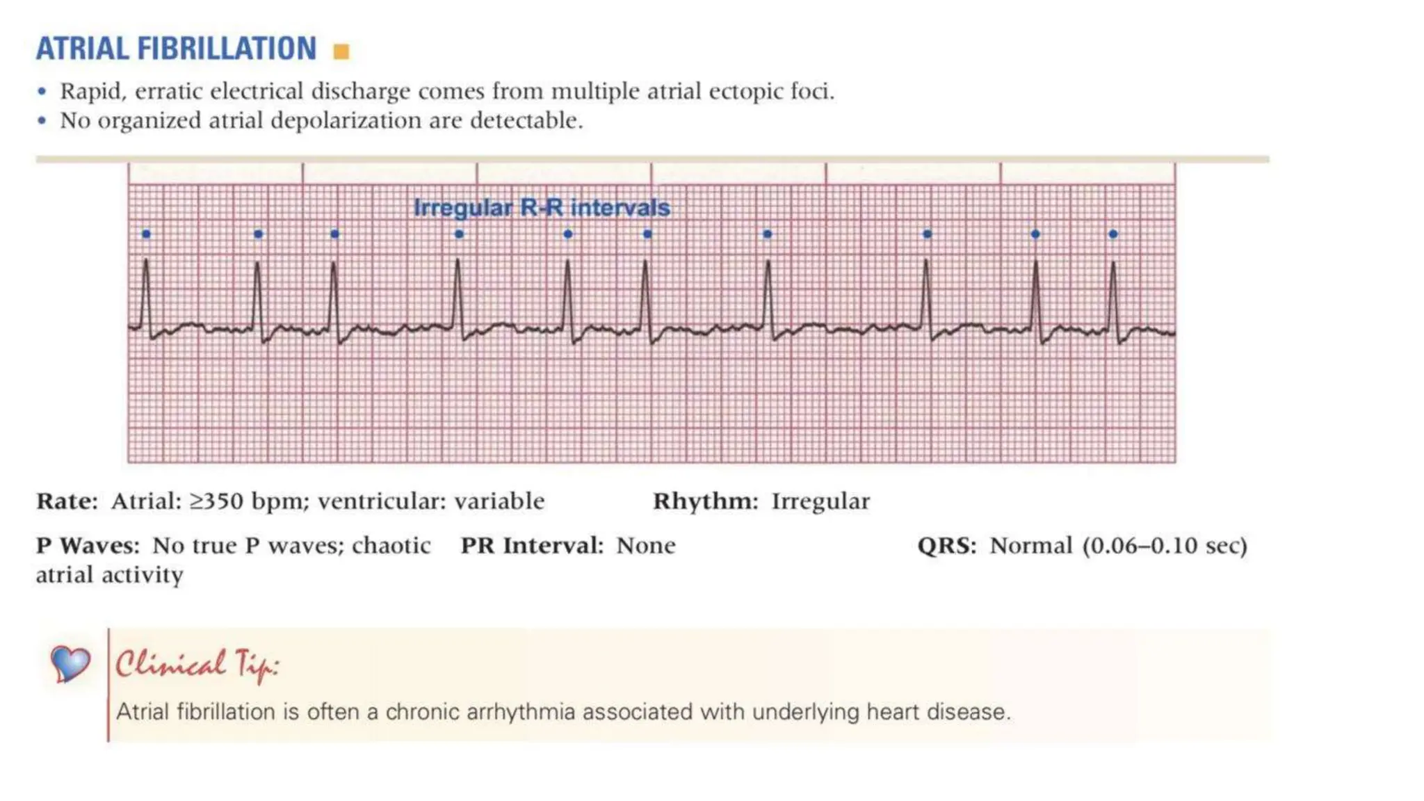 ECG slides for reference - extra copy go | PPT