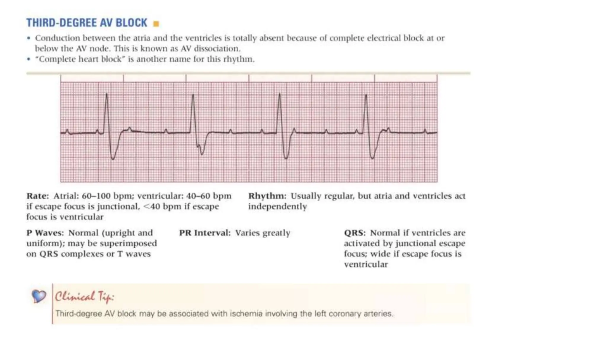 ECG slides for reference - extra copy go | PPTX