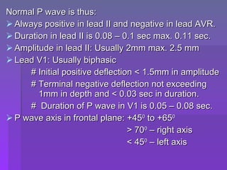 Ecg criteria of chamber enlargement | PPT