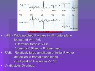 Ecg criteria of chamber enlargement | PPT
