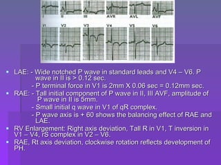 Ecg criteria of chamber enlargement | PPT