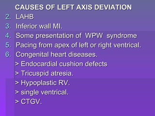 Ecg criteria of chamber enlargement | PPT