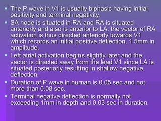 Ecg criteria of chamber enlargement | PPT