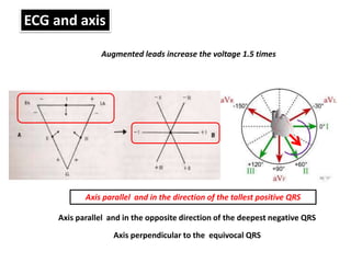 Ecg dibbs 290321_fy1 | PPT