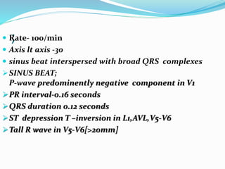 ECG: Interpolated VPCs & Fusion Beat | PPT