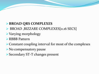 ECG: Interpolated VPCs & Fusion Beat | PPTX