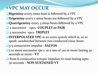 ECG: Interpolated VPCs & Fusion Beat | PPT