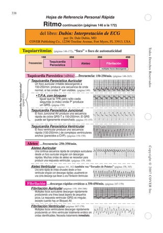 Método del Dr. Dubin para la interpretación de ECG | PDF