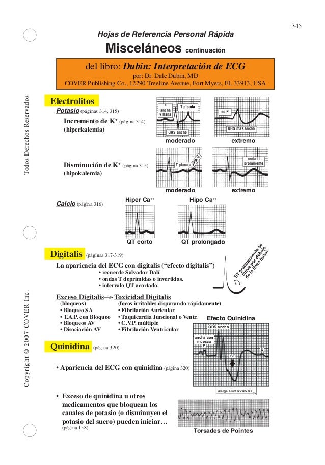 Método del Dr. Dubin para la interpretación de ECG