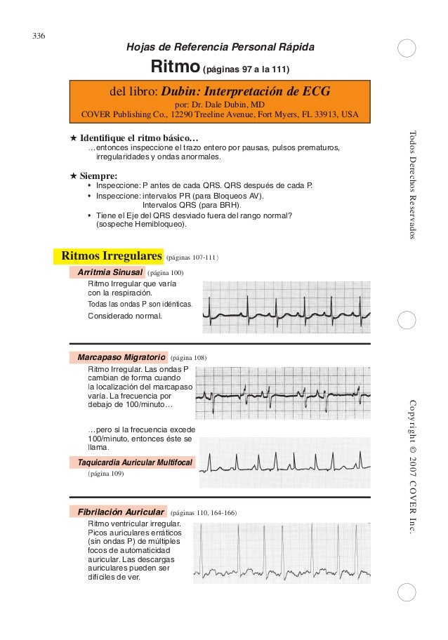 Método del Dr. Dubin para la interpretación de ECG