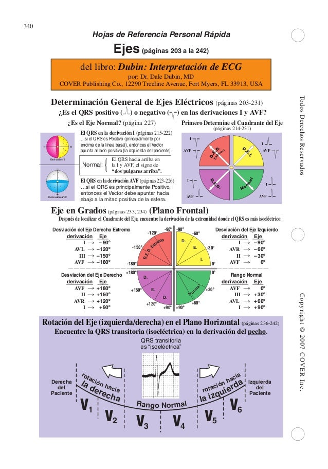 Método del Dr. Dubin para la interpretación de ECG