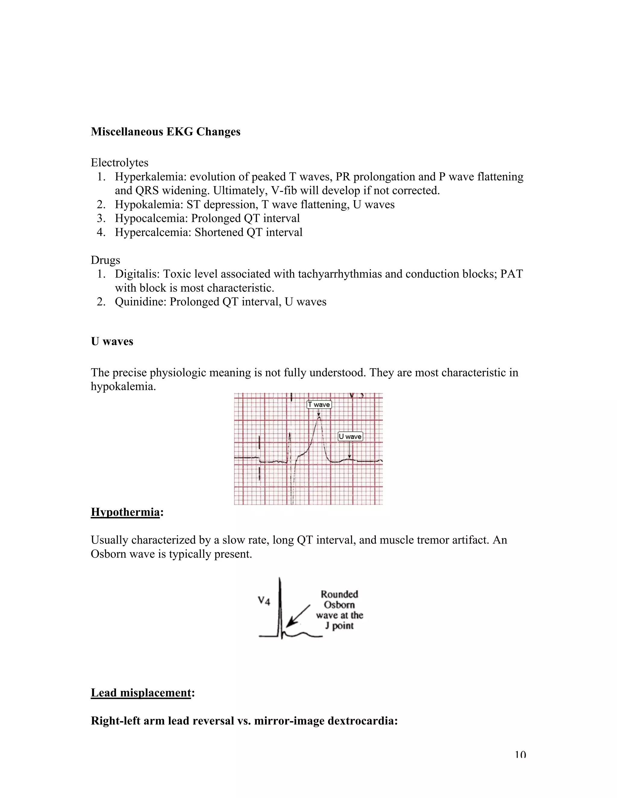 Ecg ecg abnormalities | PDF