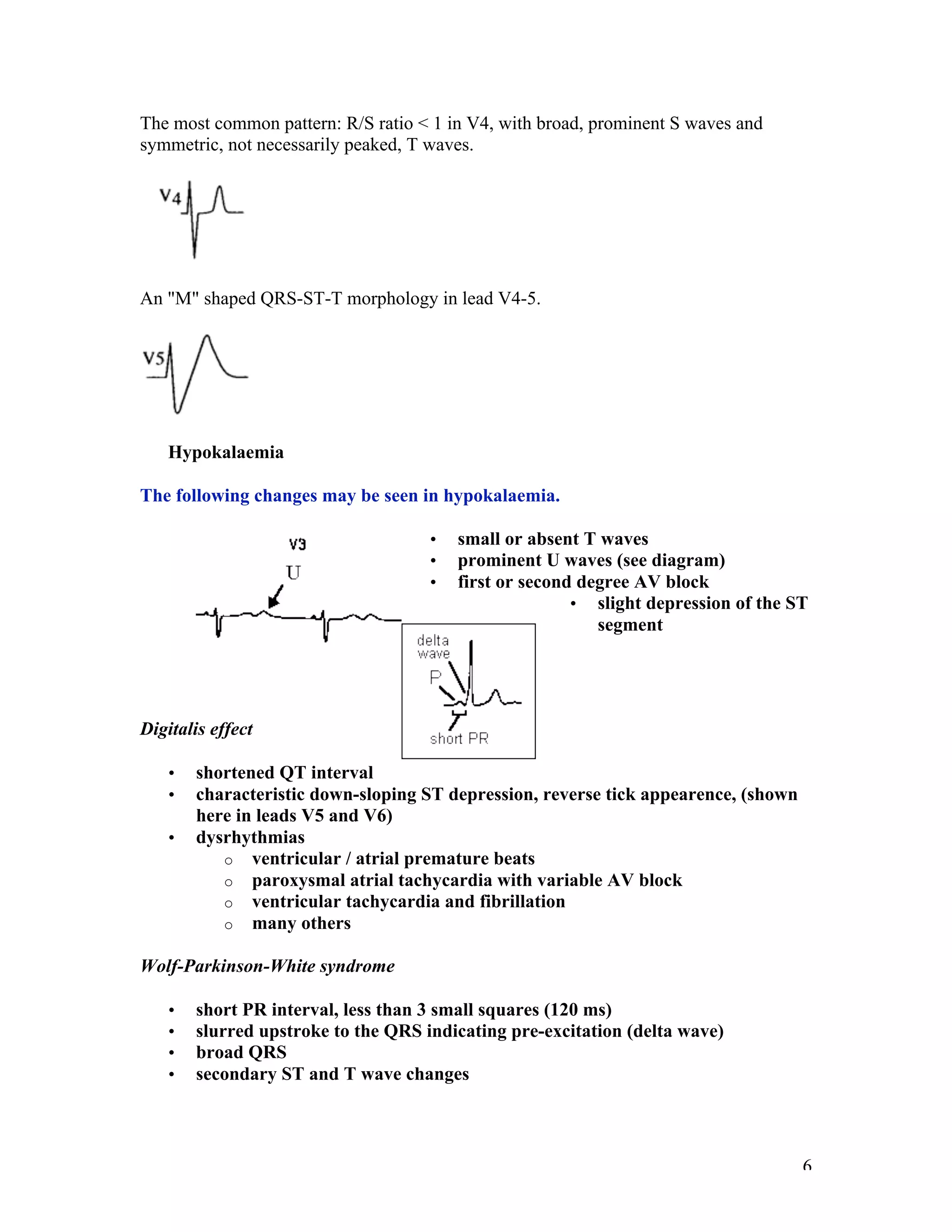 Ecg ecg abnormalities | PDF