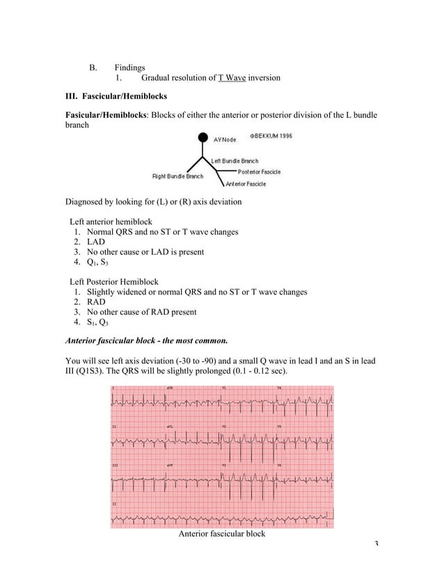 Ecg ecg abnormalities | PDF | Heart and Cardiovascular Diseases ...