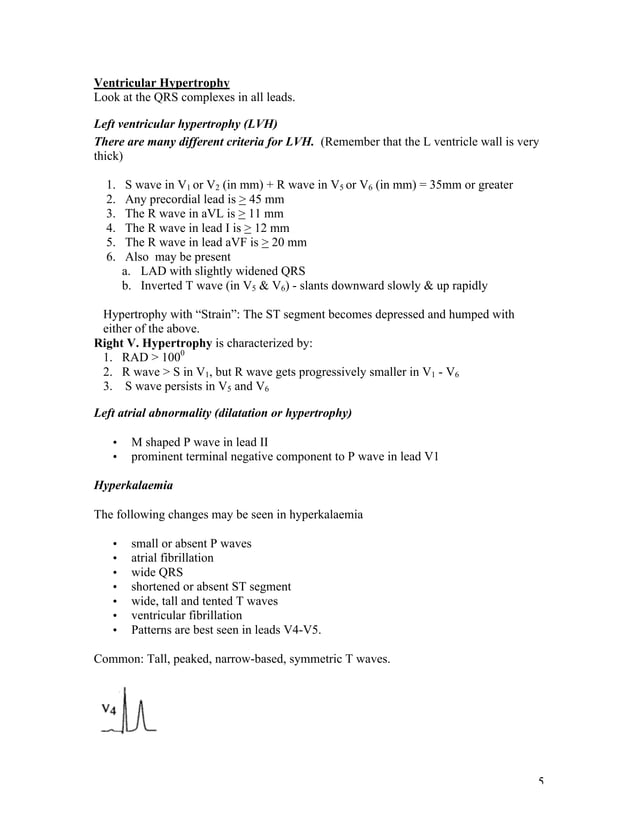 Ecg ecg abnormalities | PDF | Heart and Cardiovascular Diseases ...