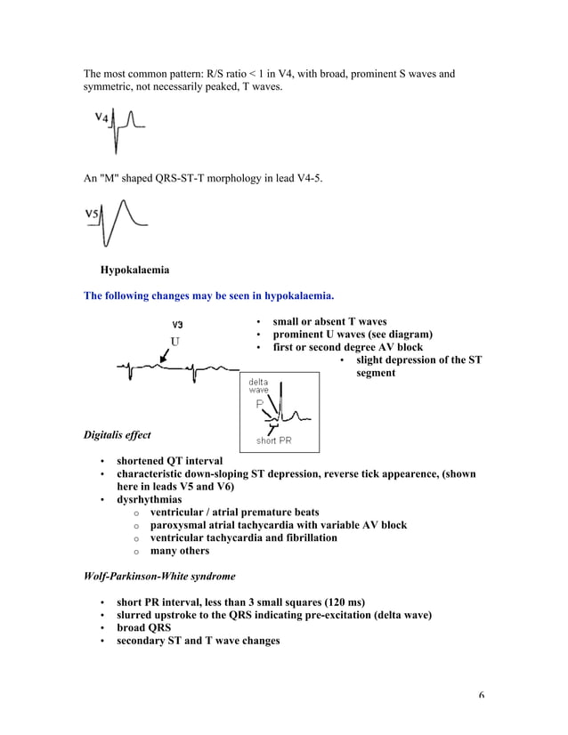 Ecg ecg abnormalities | PDF | Heart and Cardiovascular Diseases ...