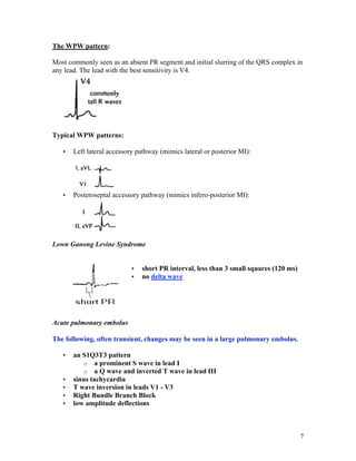 Ecg ecg abnormalities | PDF