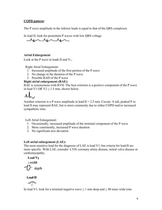 Ecg ecg abnormalities | PDF