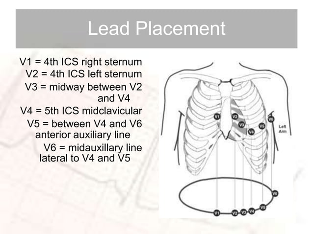 basic ECG SAMPLE WAY | PPTX | Heart and Cardiovascular Diseases ...