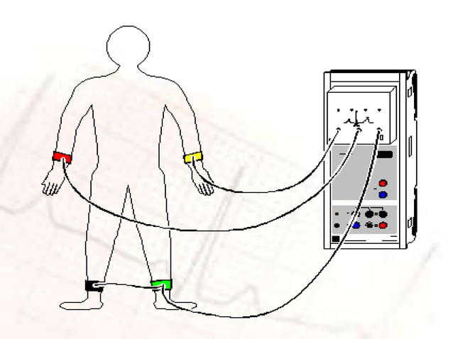 basic ECG SAMPLE WAY | PPTX | Heart and Cardiovascular Diseases ...