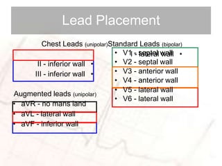 basic ECG SAMPLE WAY | PPTX