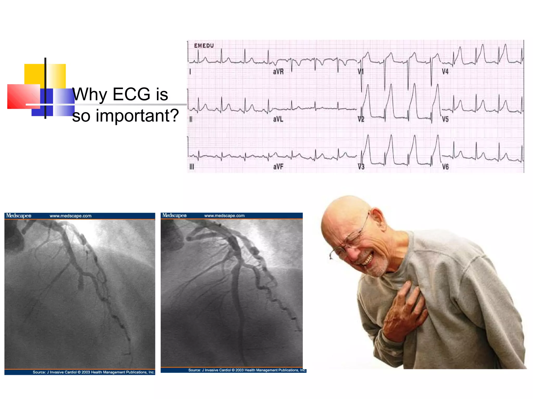 ECG Interpretation | PPT