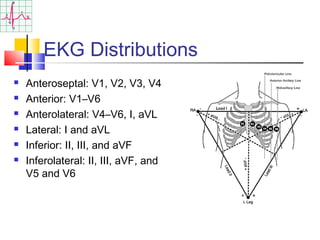 ECG Interpretation | PPT