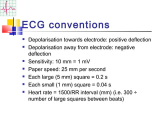 ECG Interpretation | PPT