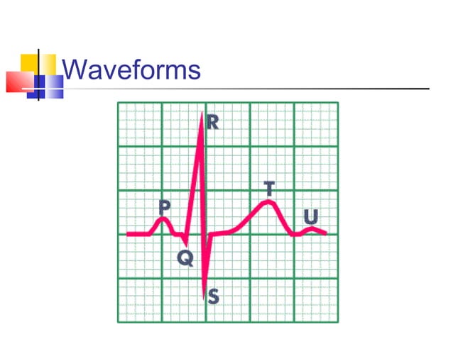 ECG Interpretation | PPT