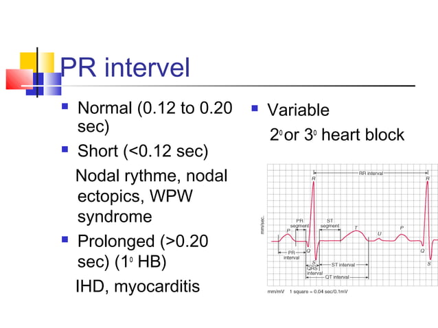 ECG Interpretation | PPT