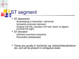 ECG Interpretation | PPT
