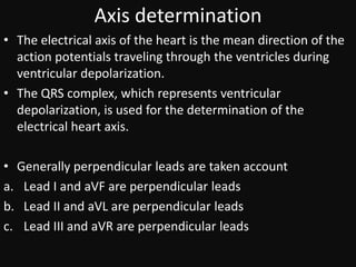 ECG [electrocardiogram].pptx