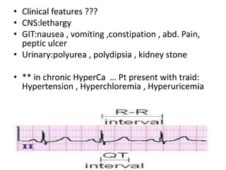 Ecg & electrolytes disturbance | PPTX