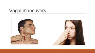 ECG emergencies | PPT