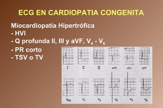 Ecg en Cardiopatías Congénitas | PPT