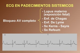 Ecg en Cardiopatías Congénitas | PPT