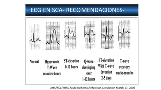 ECG EN SINDROME CORONARIO AGUDO | PPTX